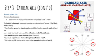 How to read an ecg | PPTX