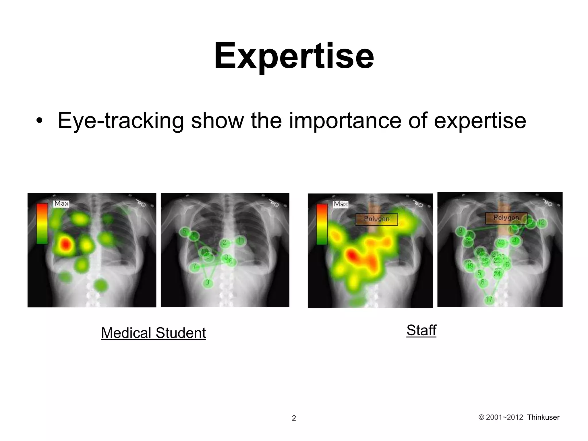 How to read a x ray-eyetracking trainging | PPTX