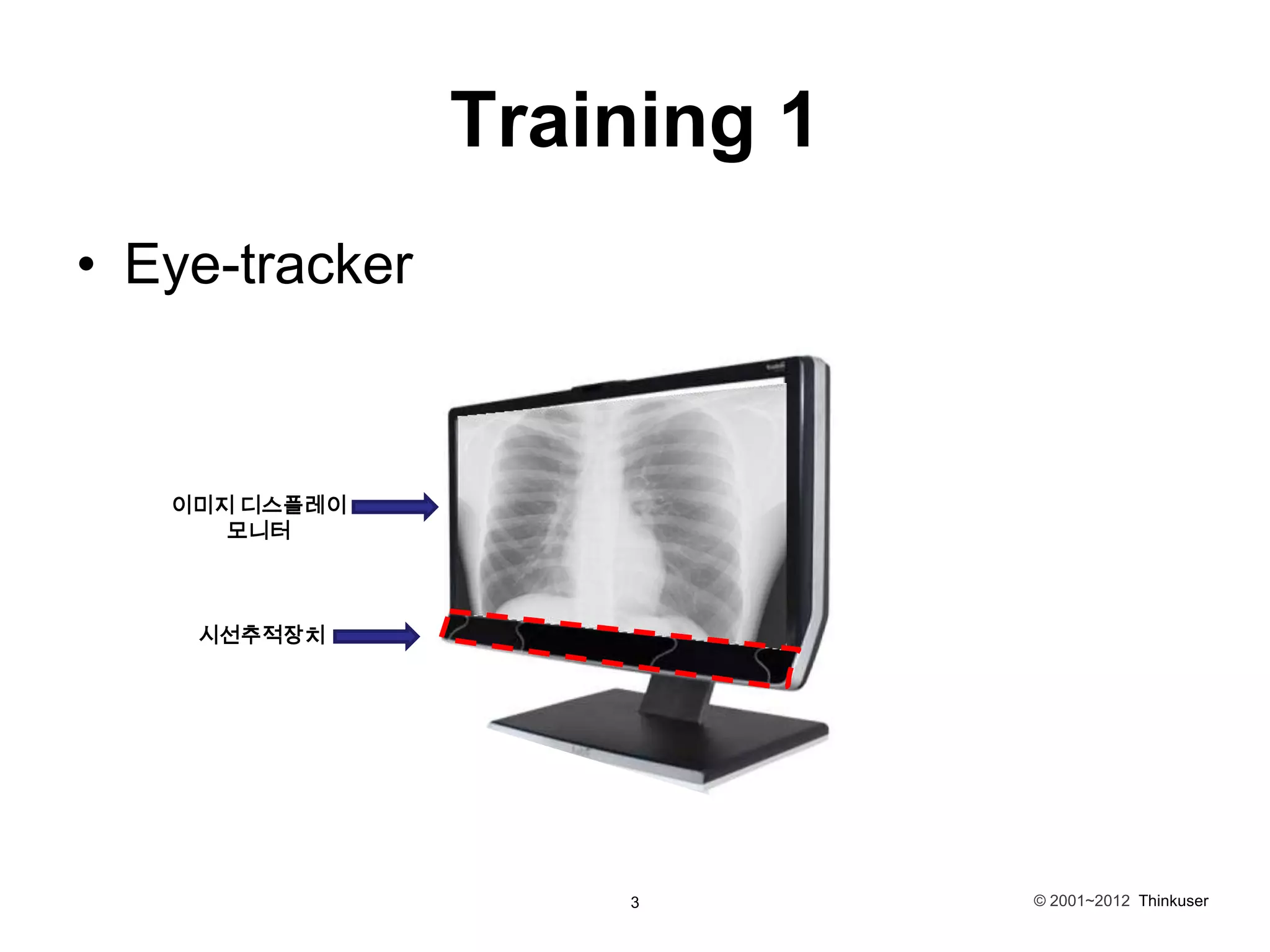 How to read a x ray-eyetracking trainging | PPTX