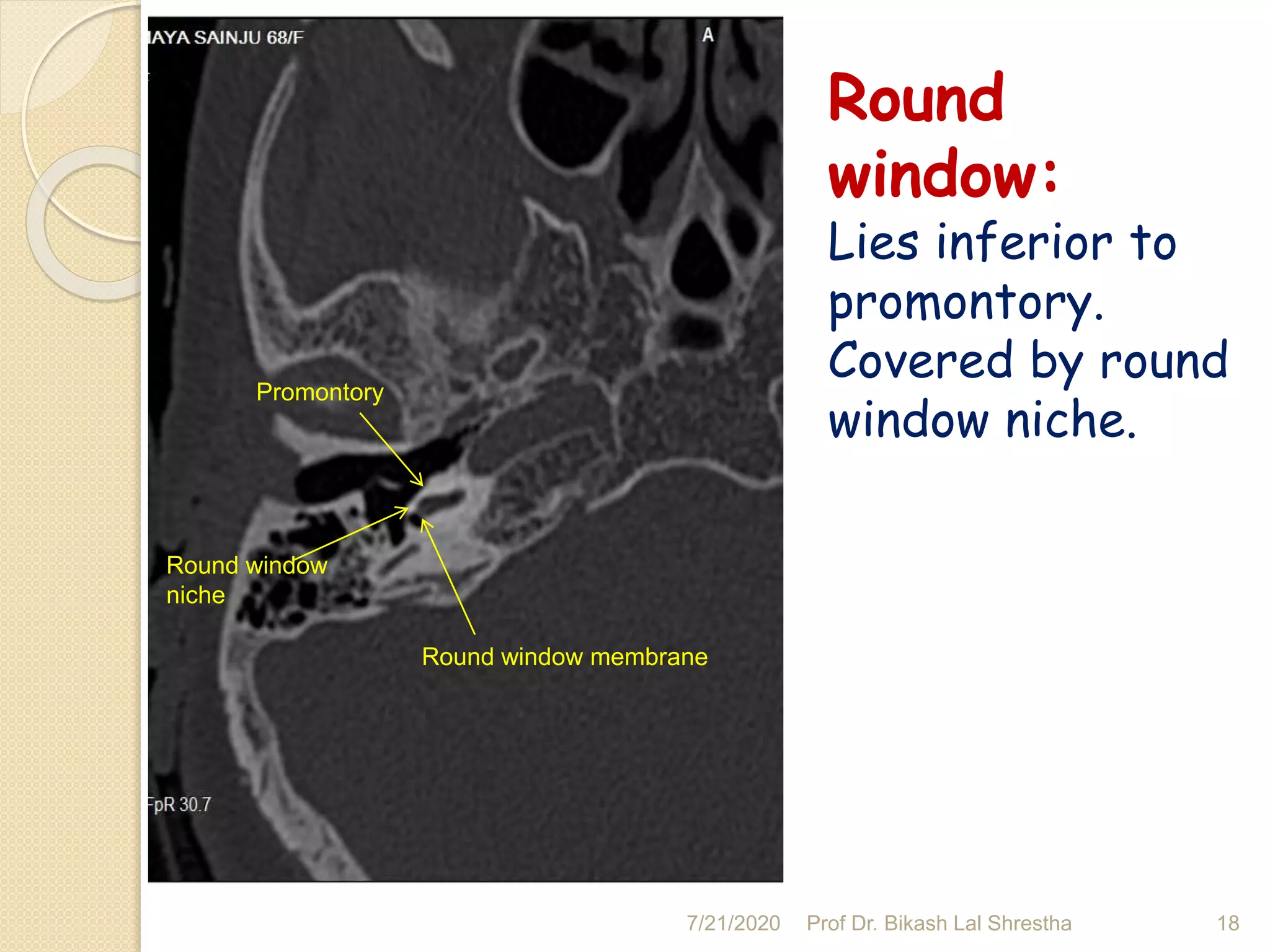How to read ct scan temporal bone - A dhulikhel hospital, kathmandu ...