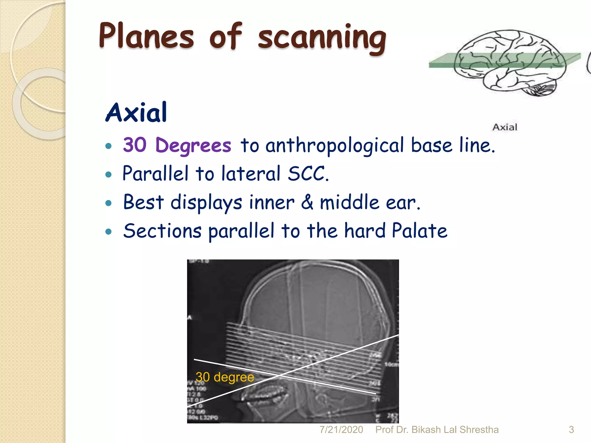 How to read ct scan temporal bone - A dhulikhel hospital, kathmandu ...