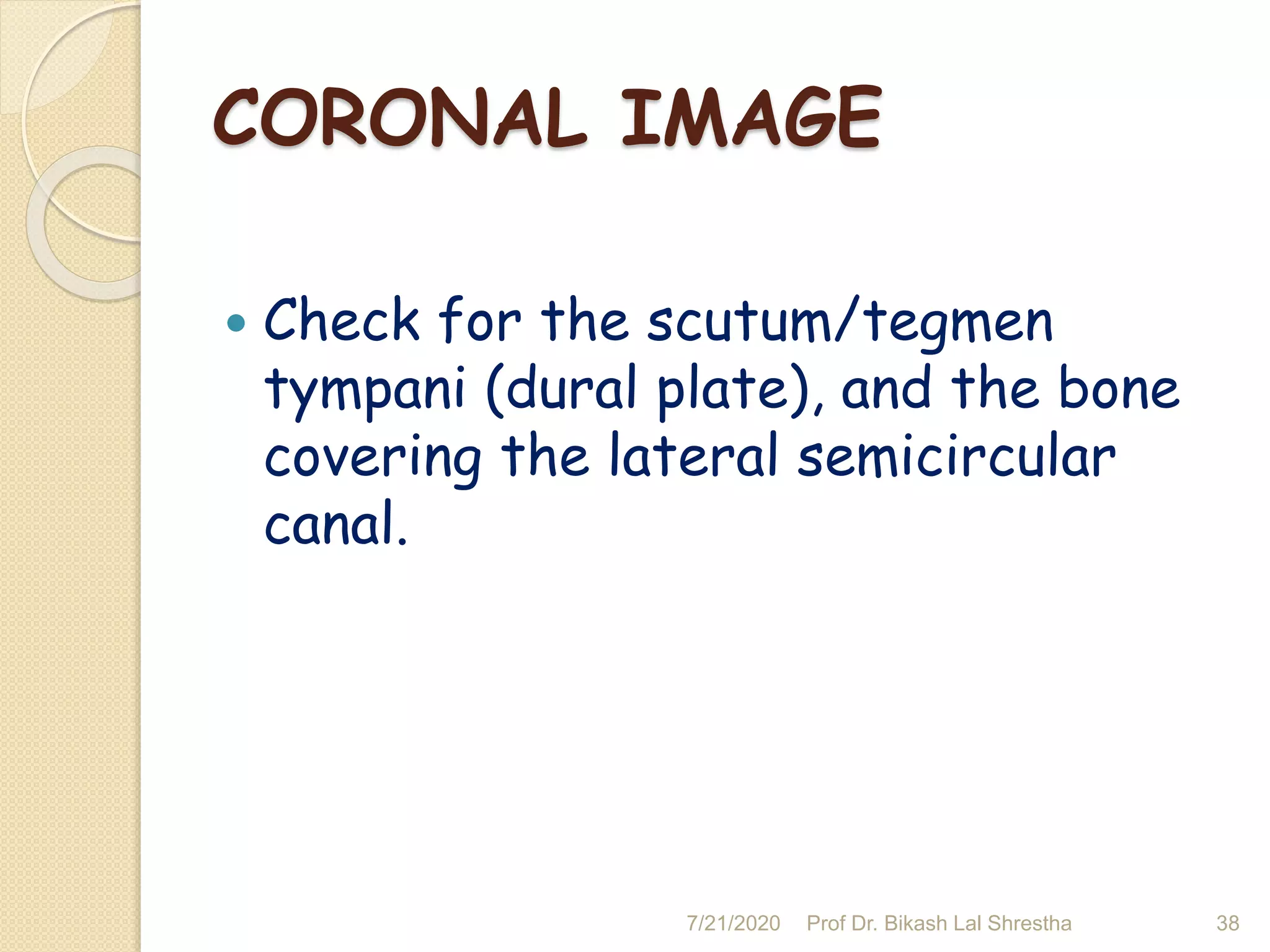 How to read ct scan temporal bone - A dhulikhel hospital, kathmandu ...