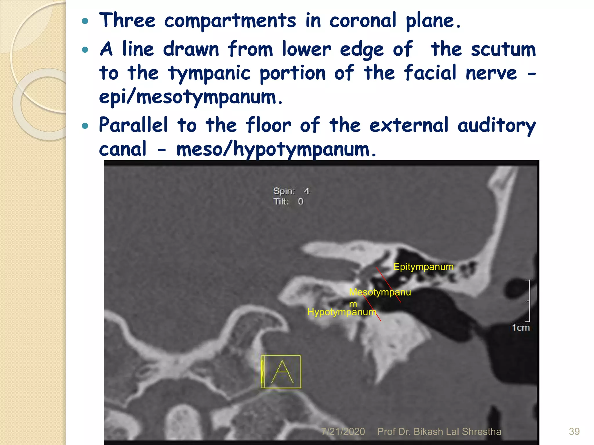 How to read ct scan temporal bone - A dhulikhel hospital, kathmandu ...