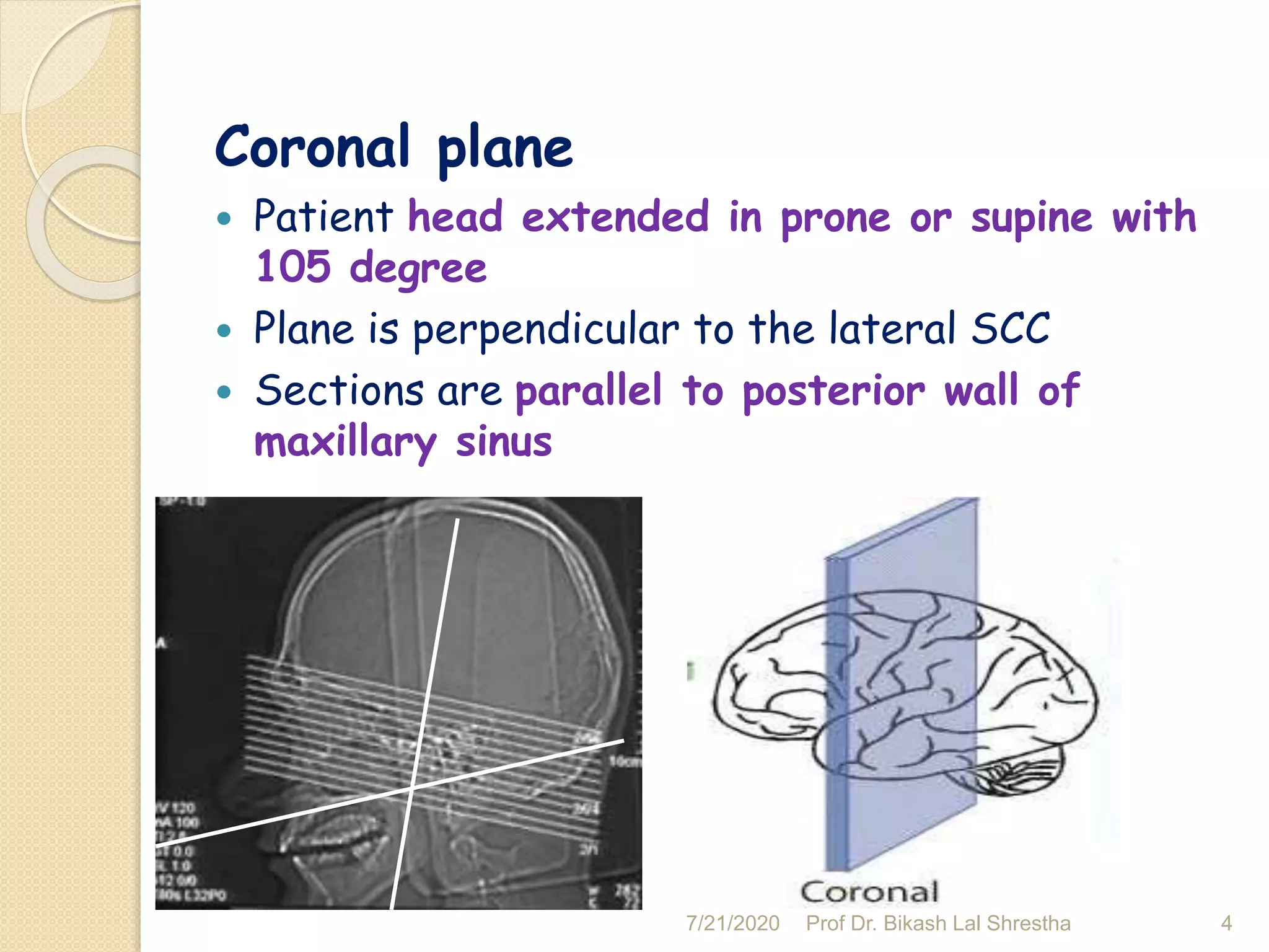 How to read ct scan temporal bone - A dhulikhel hospital, kathmandu ...