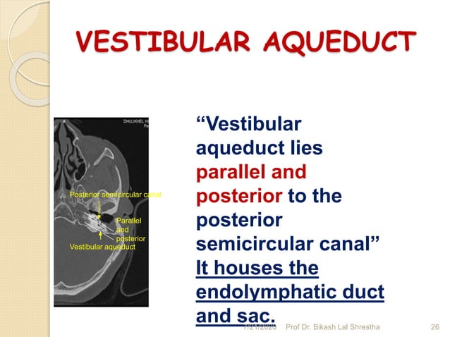 How to read ct scan temporal bone - A dhulikhel hospital, kathmandu ...