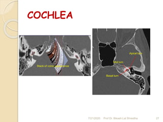 How to read ct scan temporal bone - A dhulikhel hospital, kathmandu ...