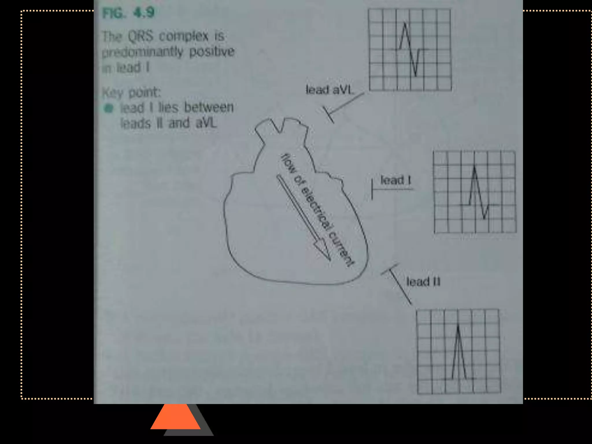 How to read ECG | PPSX