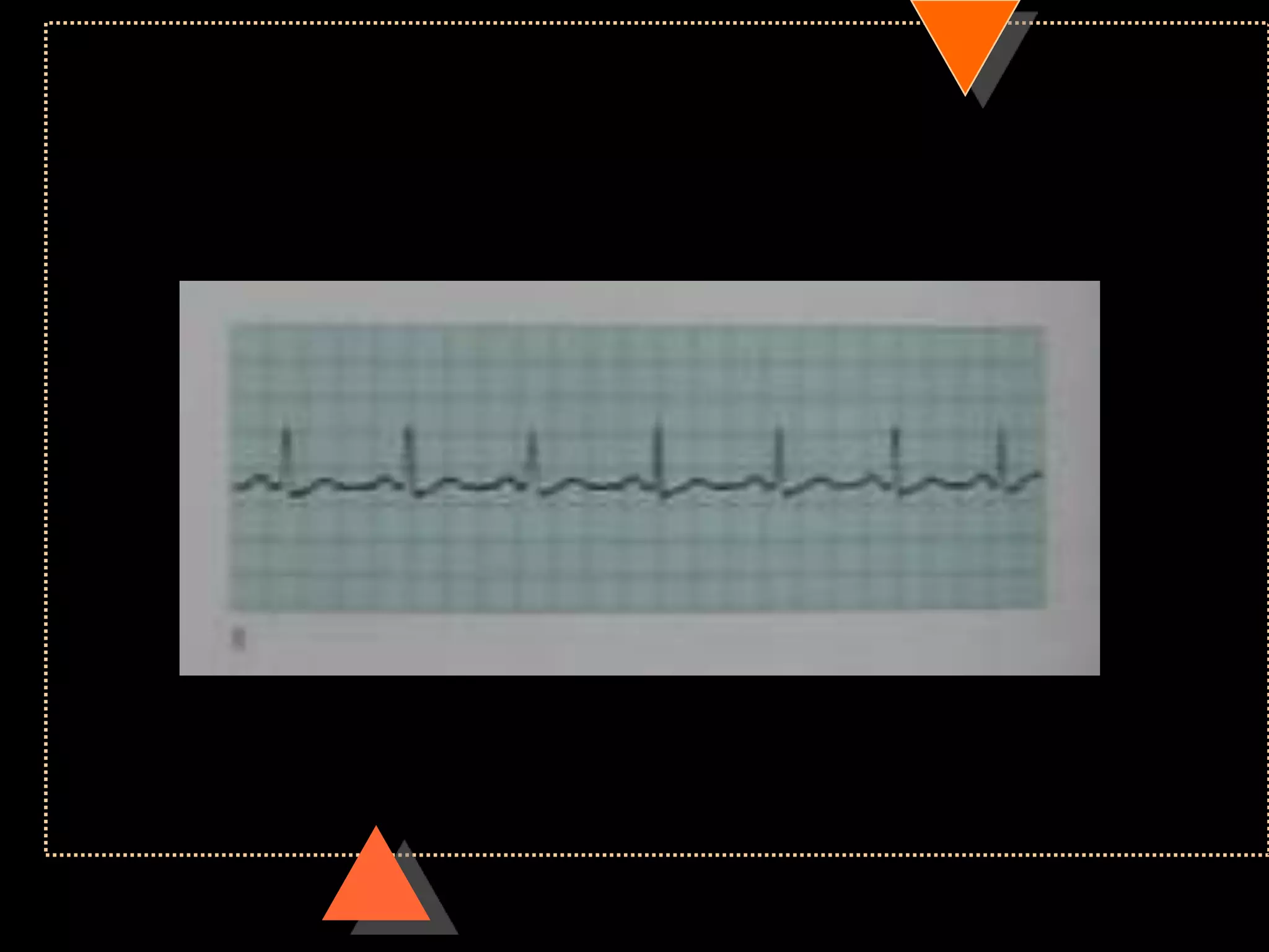 How to read ECG | PPSX