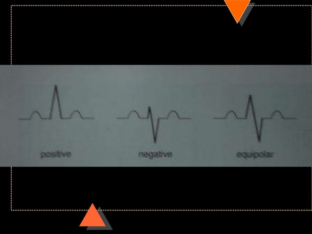 How to read ECG | PPSX
