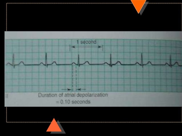 How to read ECG | PPSX
