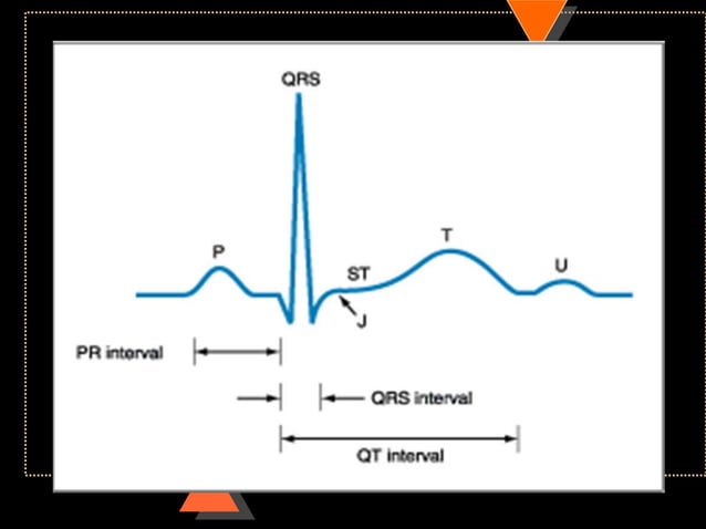 How to read ECG | PPSX