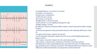 How to read 12 lead ECG | PPTX
