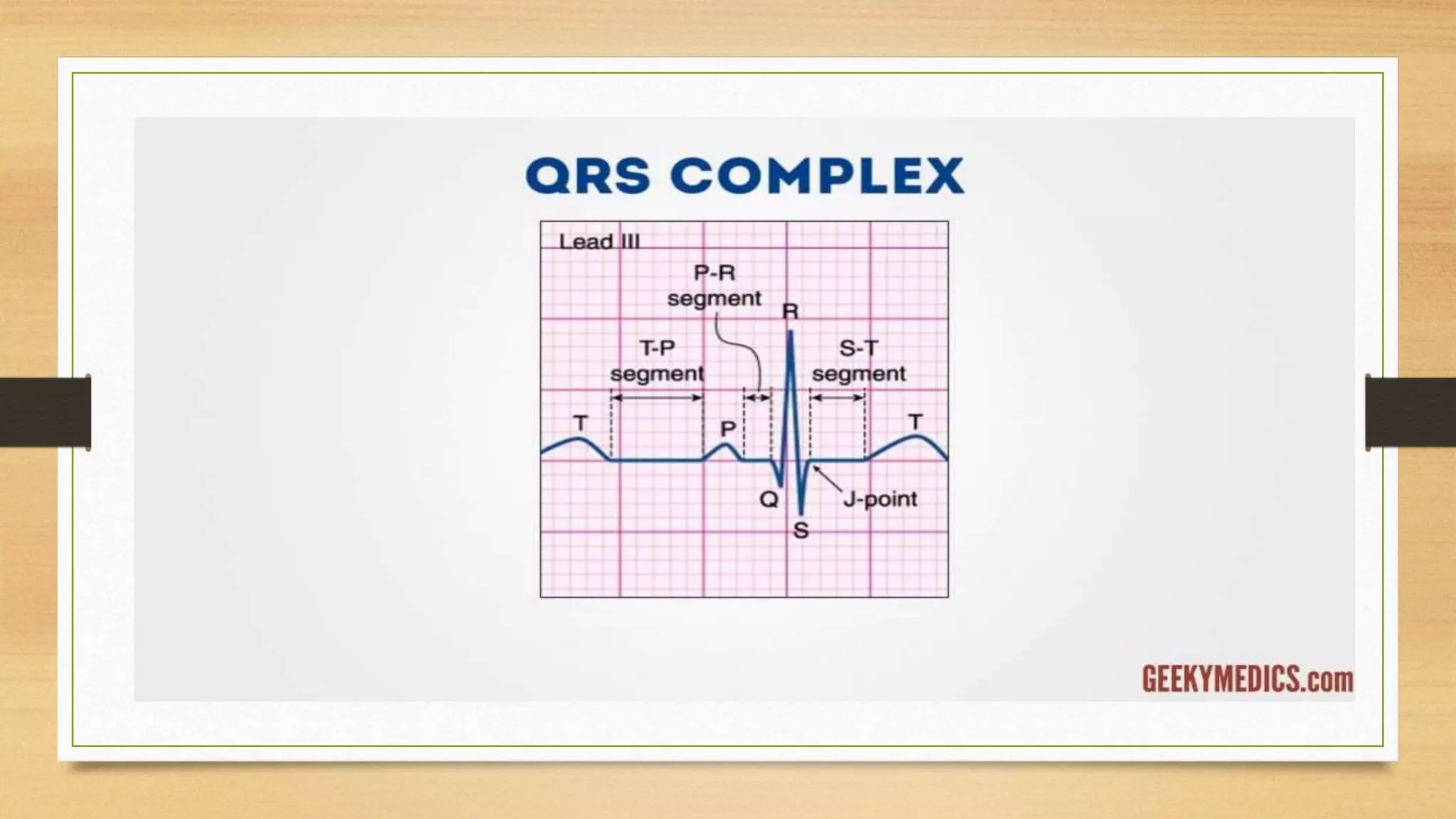 How to read ecg (basic ecg findings) | PPTX