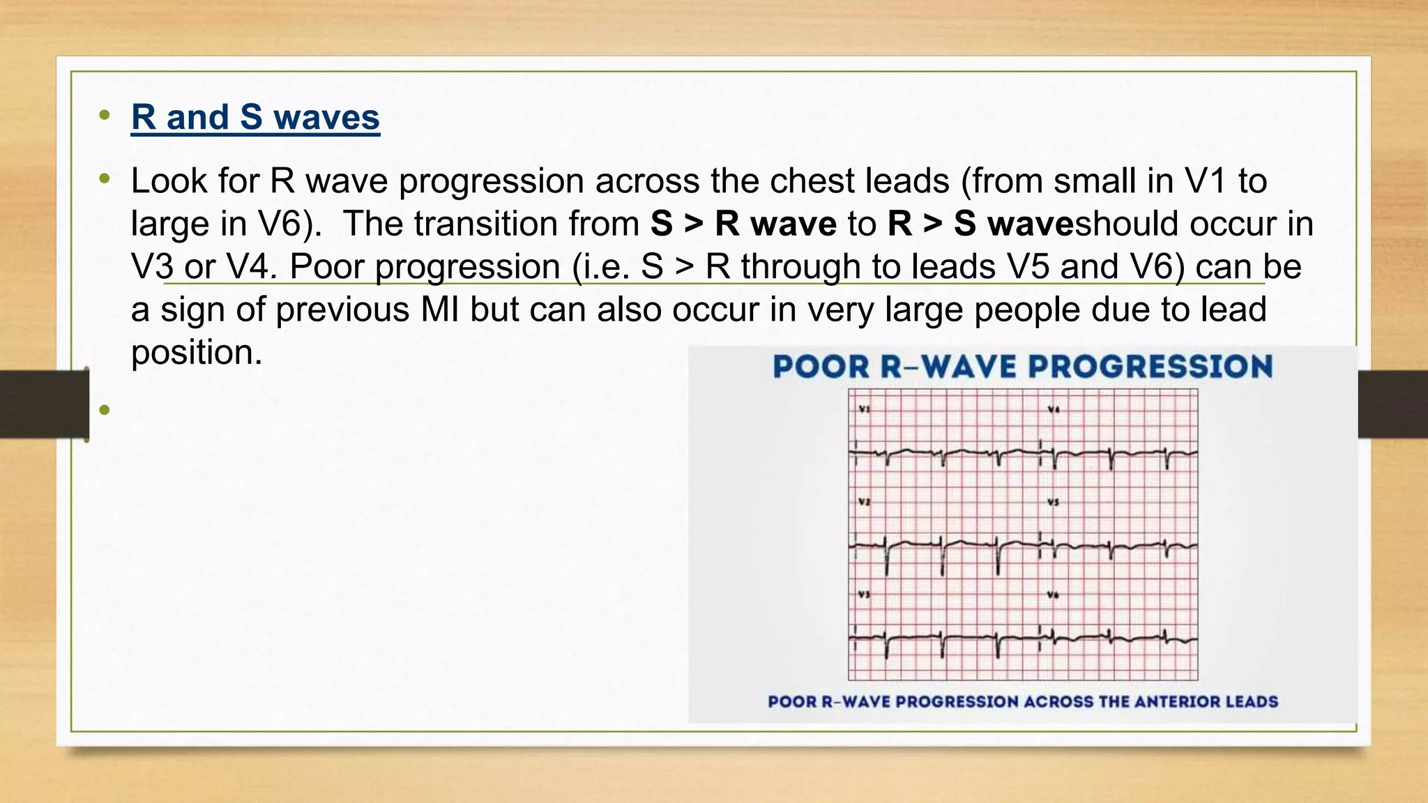 How to read ecg (basic ecg findings) | PPTX