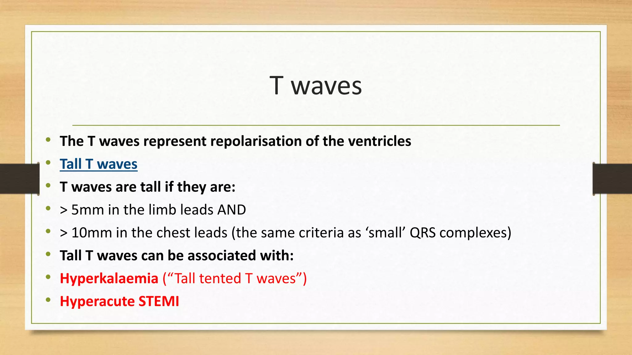 How to read ecg (basic ecg findings) | PPTX