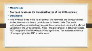 How to read ecg (basic ecg findings) | PPTX