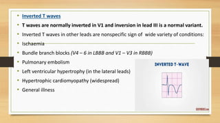 How to read ecg (basic ecg findings) | PPTX