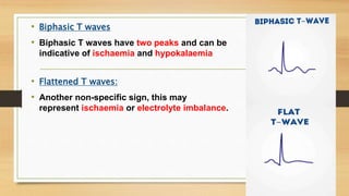 How to read ecg (basic ecg findings) | PPTX | Heart and Cardiovascular ...