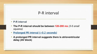 How to read ecg (basic ecg findings) | PPTX