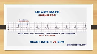 How to read ecg (basic ecg findings) | PPTX