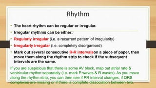 How to read ecg (basic ecg findings) | PPTX