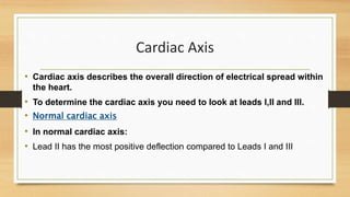 How to read ecg (basic ecg findings) | PPTX