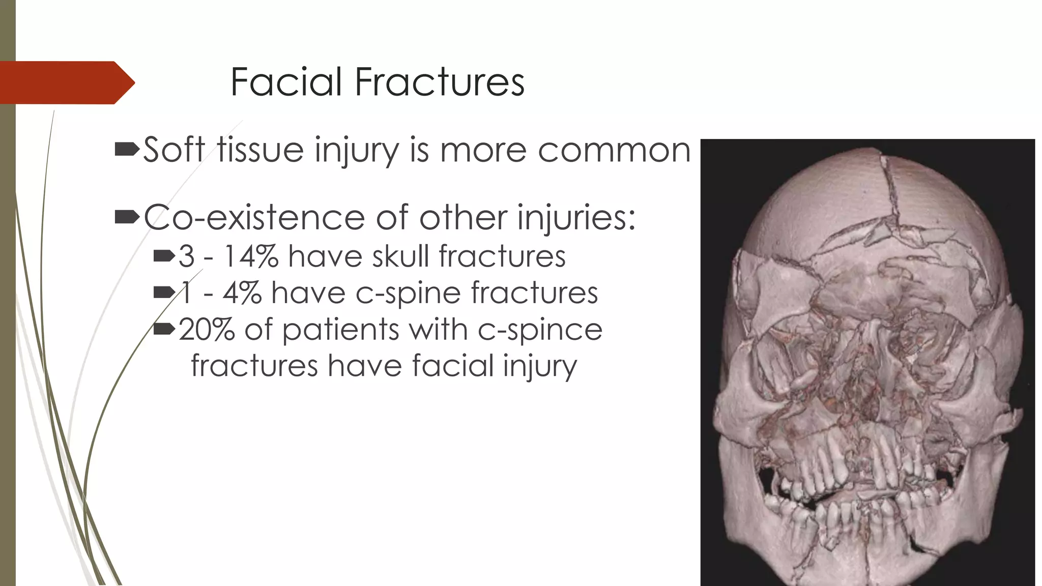How To Read Facial Bone X-Rays By Peter Andre Soltau -Jan2015 | PPTX