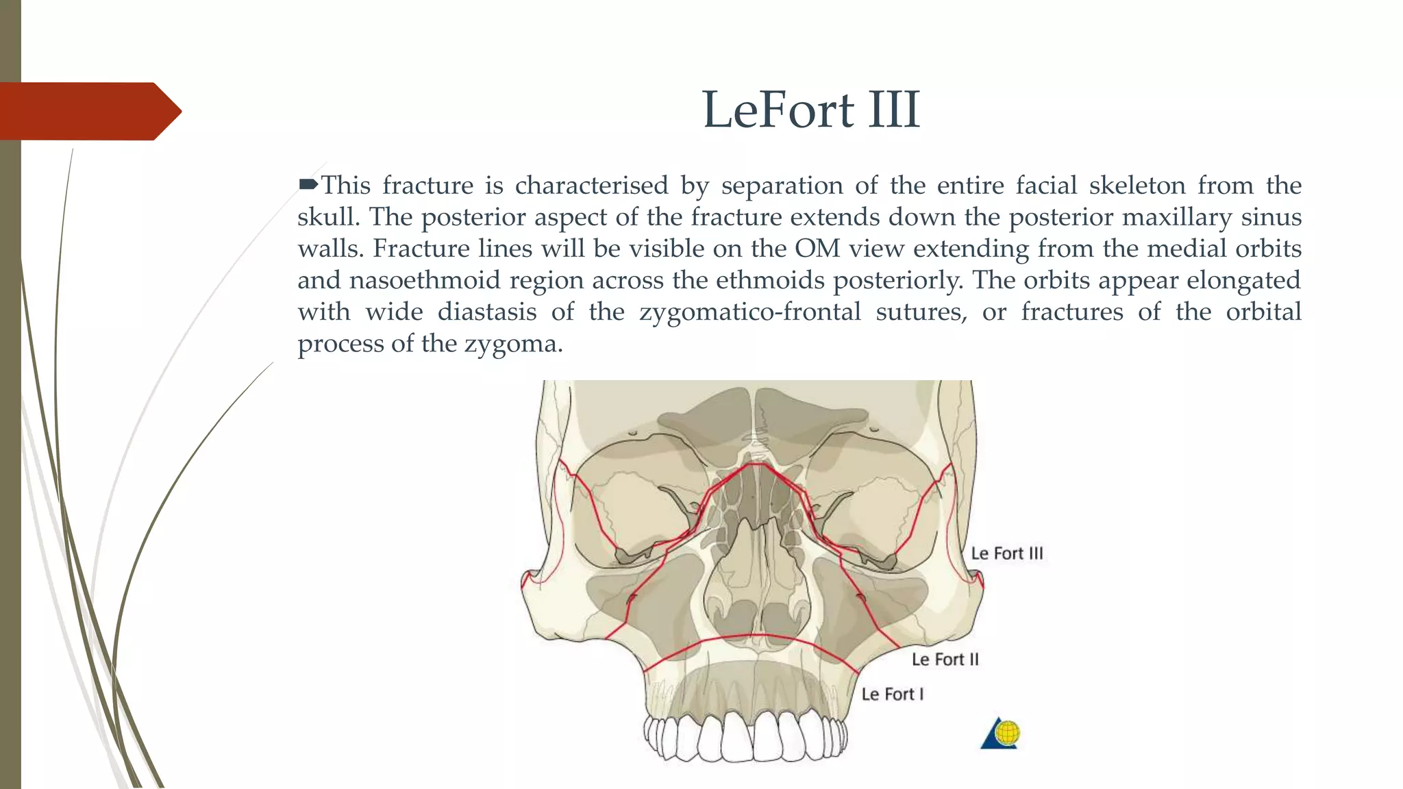 How To Read Facial Bone X-Rays By Peter Andre Soltau -Jan2015 | PPTX