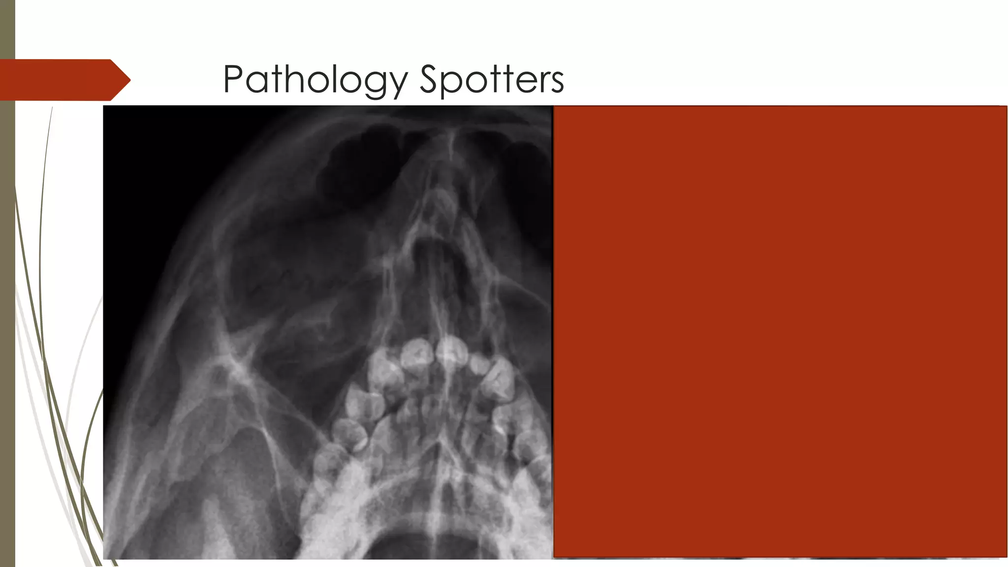 How To Read Facial Bone X-Rays By Peter Andre Soltau -Jan2015 | PPTX