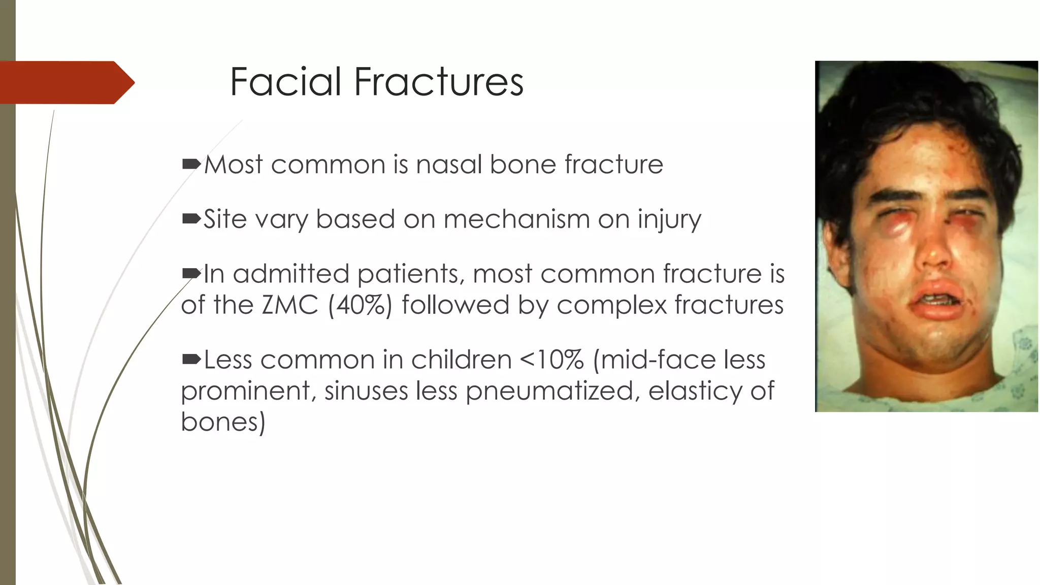 How To Read Facial Bone X-Rays By Peter Andre Soltau -Jan2015 | PPTX