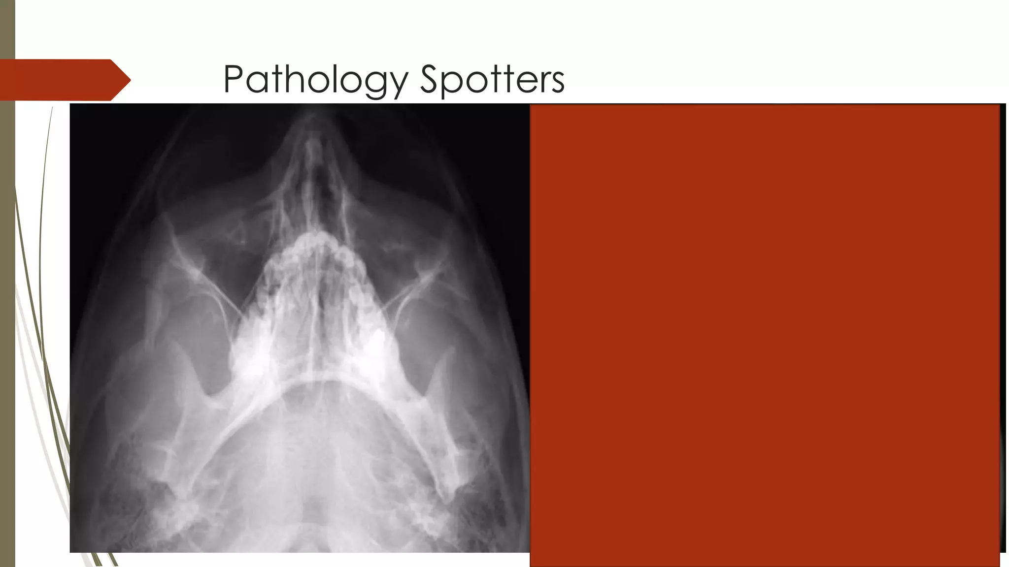 How To Read Facial Bone X-Rays By Peter Andre Soltau -Jan2015 | PPTX