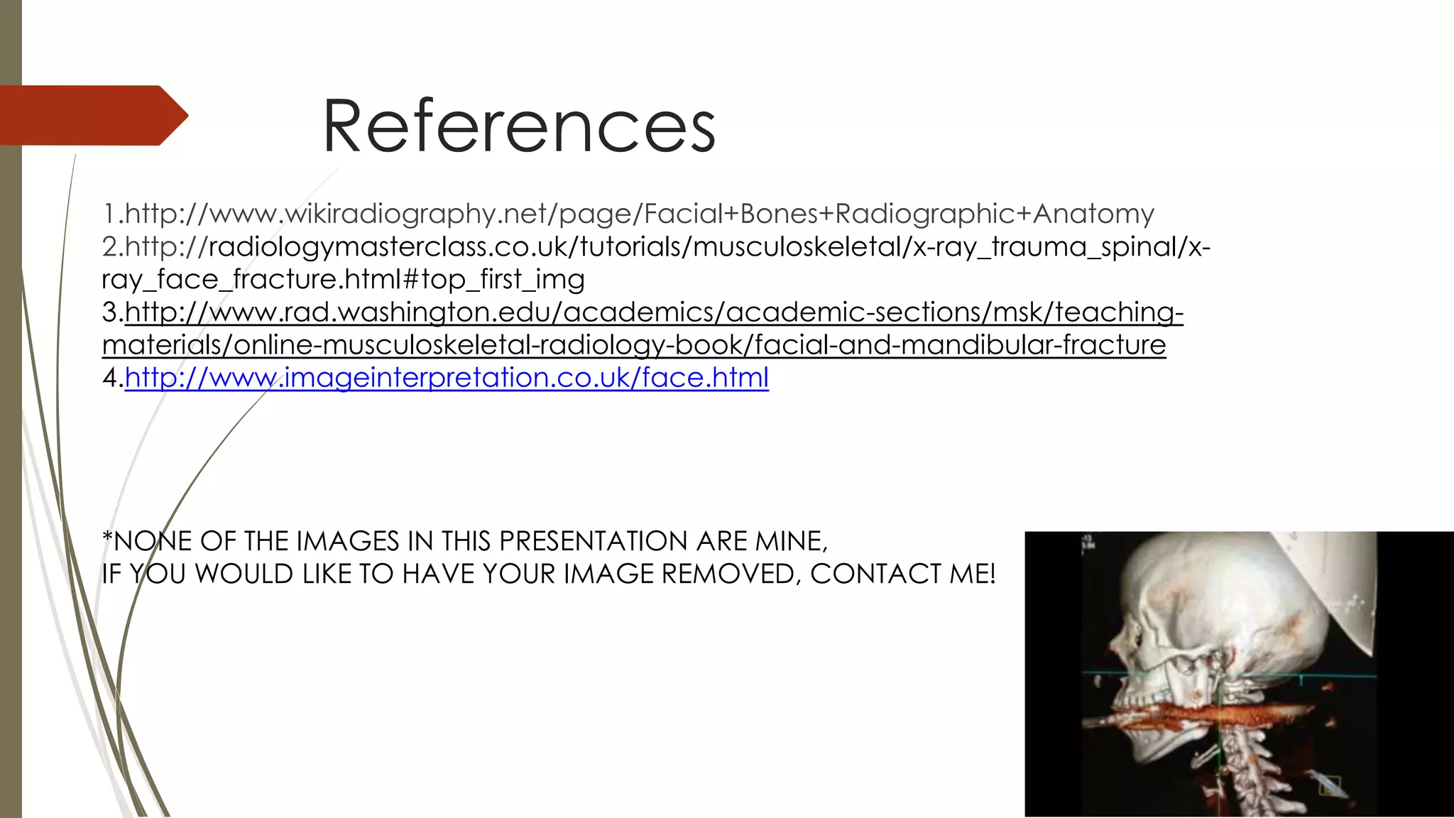 How To Read Facial Bone X-Rays By Peter Andre Soltau -Jan2015 | PPTX