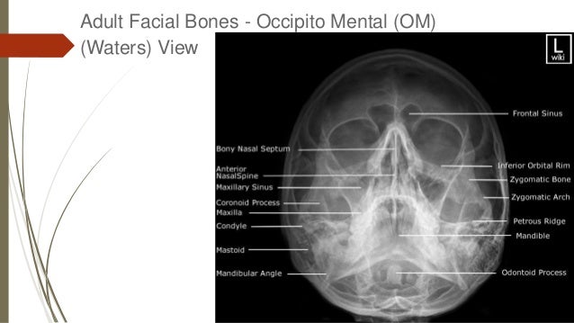 How To Read Facial Bone X-Rays By Peter Andre Soltau -Jan2015