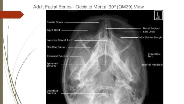 How To Read Facial Bone X-Rays By Peter Andre Soltau -Jan2015