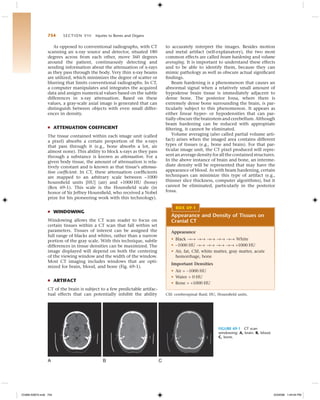 Head CT | PDF