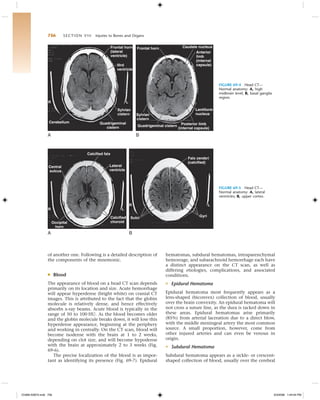 Head CT | PDF