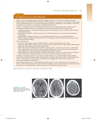 Head CT | PDF