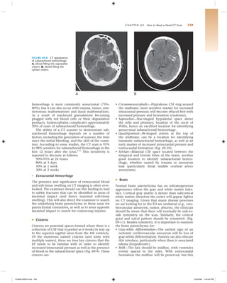 Head CT | PDF