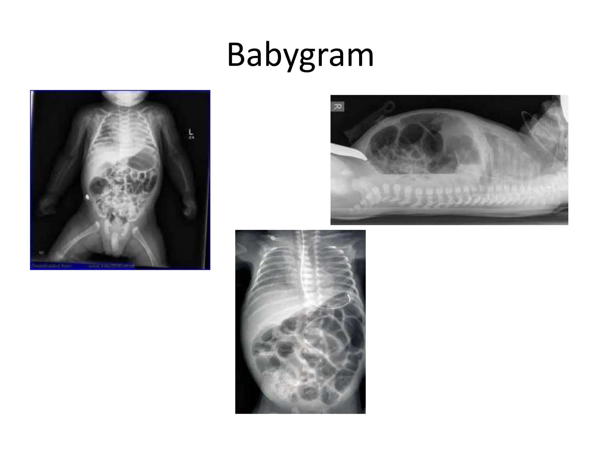 Bagaimana cara membaca foto rontgen/x-ray | PPT