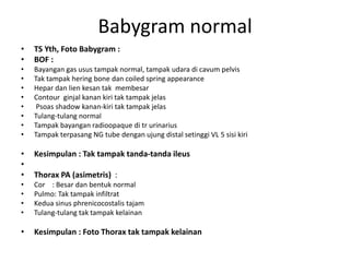 Bagaimana cara membaca foto rontgen/x-ray | PPT