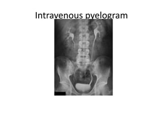 Bagaimana cara membaca foto rontgen/x-ray | PPT