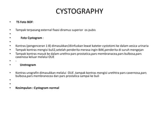 Bagaimana cara membaca foto rontgen/x-ray | PPT