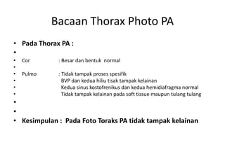 Bagaimana cara membaca foto rontgen/x-ray | PPT