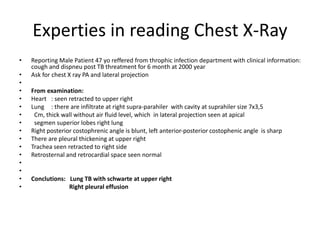 Bagaimana cara membaca foto rontgen/x-ray | PPT