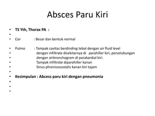 Bagaimana cara membaca foto rontgen/x-ray | PPT