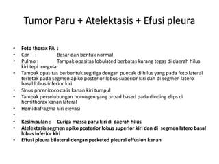 Bagaimana cara membaca foto rontgen/x-ray | PPT