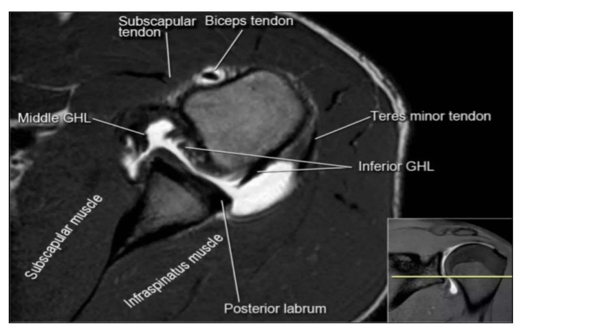 HOW TO READ SHOULDER MRI | PPTX