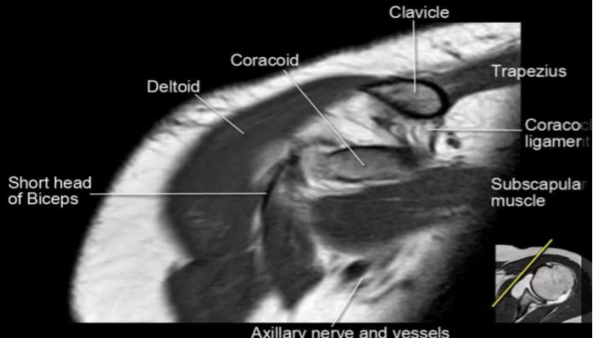 HOW TO READ SHOULDER MRI | PPTX