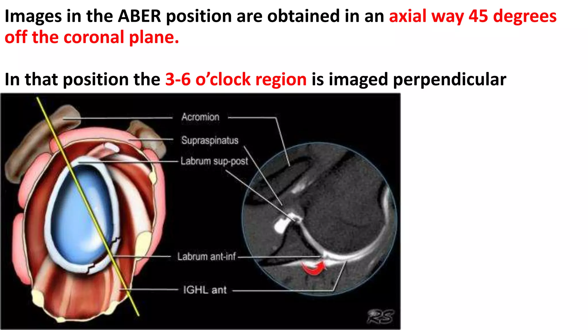 HOW TO READ SHOULDER MRI | PPTX