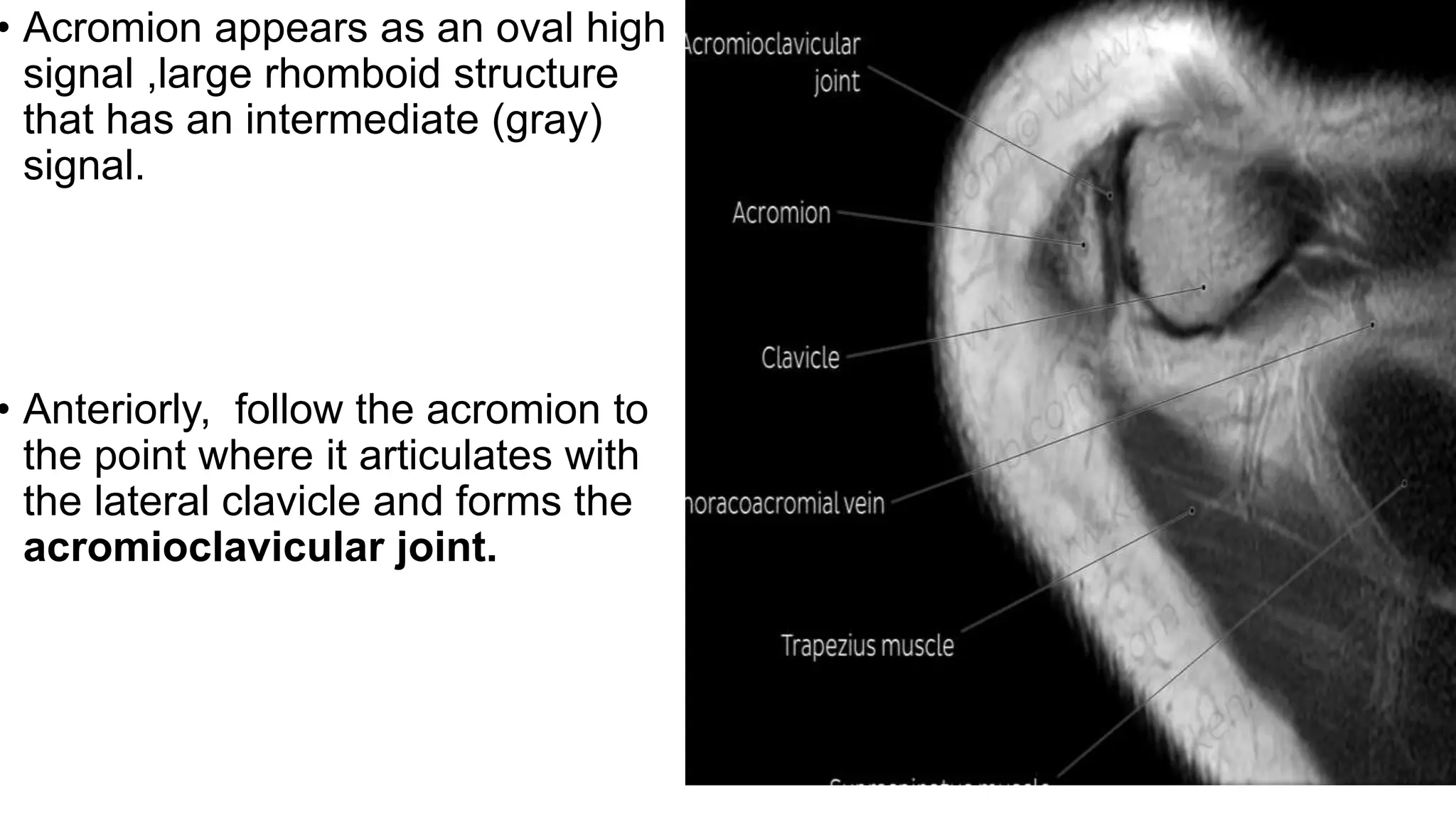 HOW TO READ SHOULDER MRI | PPTX